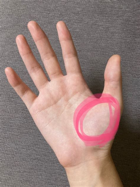 손바닥 통증 지식in