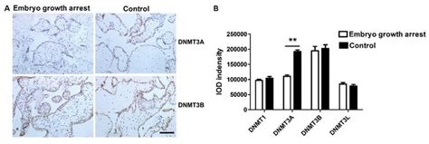 Semi Quantitative Analysis Of Dnmt Protein Expression In Chorionic