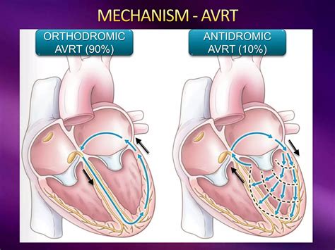 Atrial Tachy 26 Oct 22 Pptx