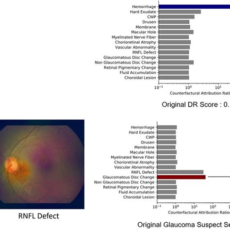 interactive diagnosis using counterfactual attribution ratio and the