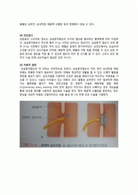 아동간호학 심실중격결손vsd Case