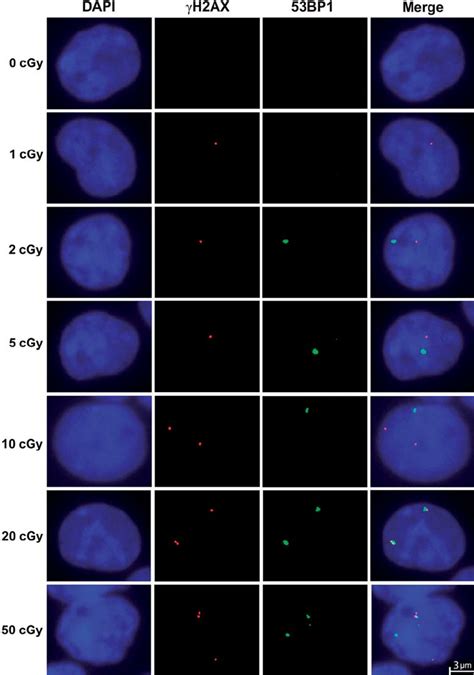 Radiation induced 53BP1 and γ H2AX foci in nuclei of UCB lymphocytes