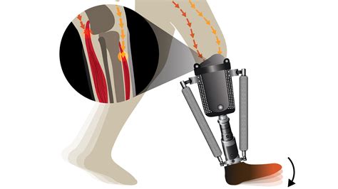 Biomedical Engineering Prosthetic Limbs