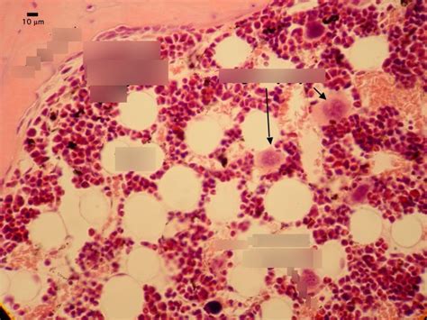 Bio 313 Red Bone Marrow Histology Diagram Quizlet
