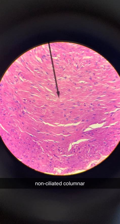 Non Ciliated Columnar