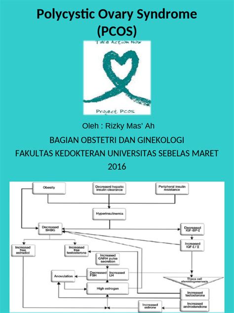 Fix Ppt Polycystic Ovary Syndrome Pcos Pdf