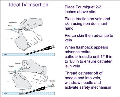 35 IV Therapy Tips Tricks For Nurses NurseBuff