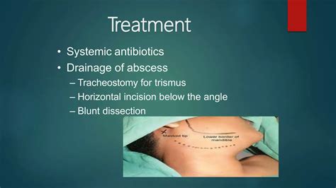 Peritonsillar Abscess Parapharyngeal Abscess Retropharyngeal Abscess