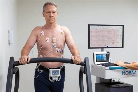 Ekg Vs Ecg—whats The Difference Norav Medical