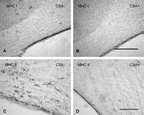 Brightfield Photomicrographs Showing Mhc Classes I And Ii Expression In