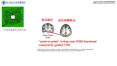 【学术报告整理】功能磁共振对异常脑活动精准定位并引导精准定位tms治疗 脑医汇