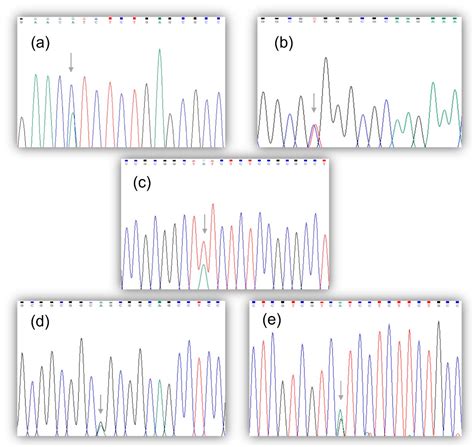 Genes Free Full Text Variants Identified In The Hoxc13 And Hoxd13