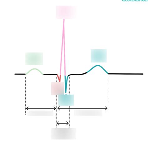 Ekg Diagram Quizlet