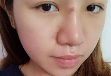 14种鼻型图解揭秘：鼻子类型有很多鼻子外观好能影响运势小狼观天下