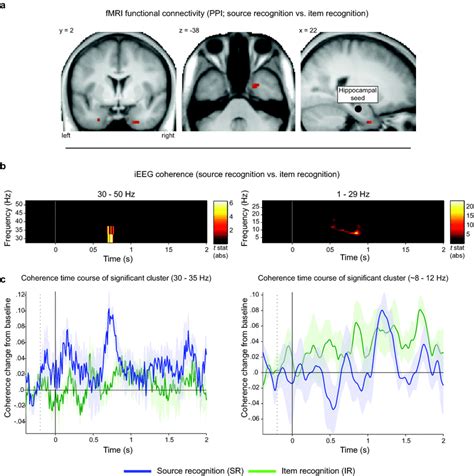 Functional Coupling Between Hippocampus And Perirhinal Cortex Increases Download Scientific