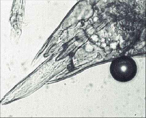 Aspect Of Genital Ampoulae Of T Chilonis Male Photograph By E
