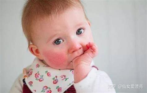 为什么婴儿爱长湿疹？婴儿湿疹能用乳木果油吗？ 知乎