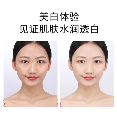 Отбеливающая лицевая Сыворотка для лица анти лечение акне увлажнение жидкий уход за кожей