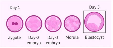 Embryo Grading And Ivf Success Rates Ivf Conceptions