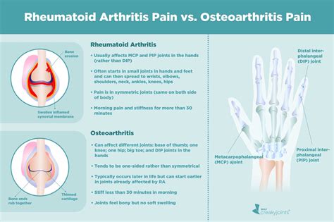 Knee Arthritis Chart Osteoarthritis Leo Löwchen