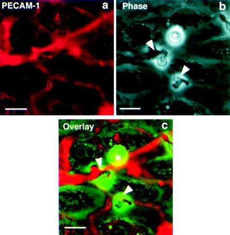 Live Time Assessment Of Monocytes Transmigration Across Activated Huvec