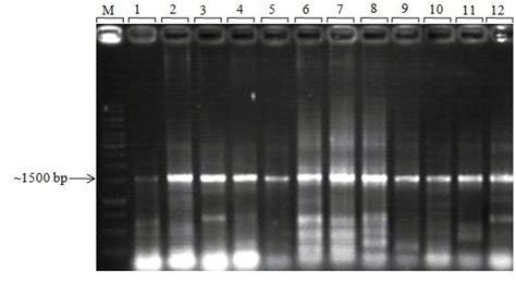 Isolation And Molecular Identification Of Streptomyces Spp With Antibacterial Activity From