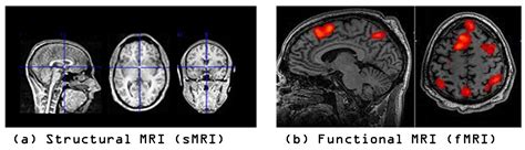 Multi Slice Generation Smri And Fmri For Autism Spectrum Disorder Diagnosis Using 3d Cnn And