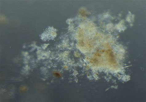 Cheese Mold Under Microscope