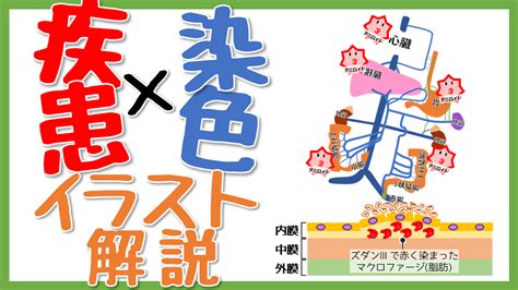【グロコット 染色】真菌の染色。ポイントは目黒のパン屋｜どっと New Life