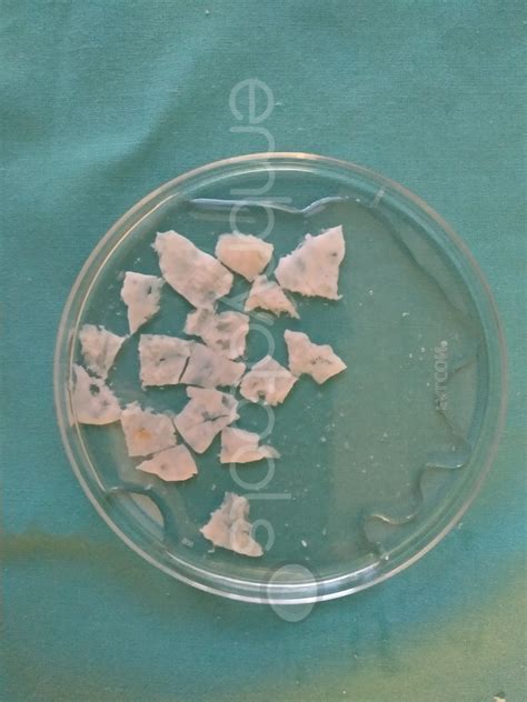 06 Ovarian Tissue Cryopreservation Embryotools