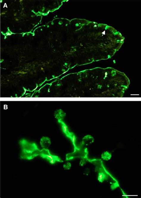 Localization Of Lectin Pna By Fluorescence Microscopy A A Distinct Download Scientific