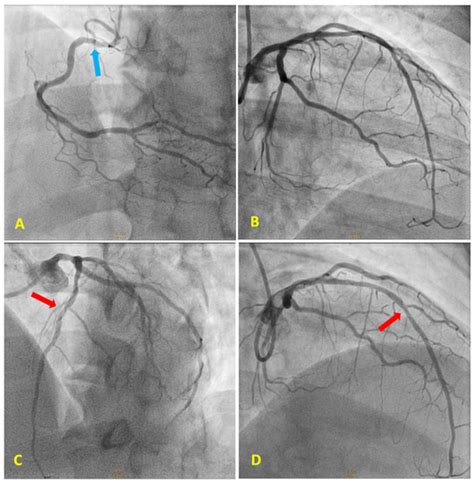 Diagnostics Special Issue Whats New In Diagnostic Radiological