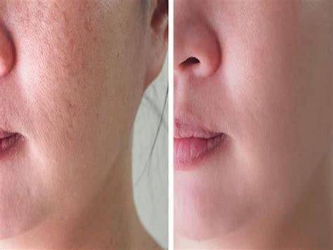 Skin Care Routine રાત્રે સૂતા પહેલા ચહેરા પર લગાવો આ તેલ સ્કિન ટાઈટ