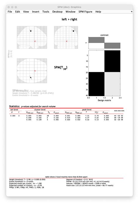 Two Sample T Test Spm Documentation
