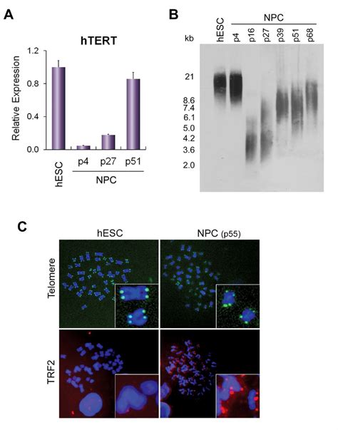 No Correlation Between Trf2 Expression And Telomere Length Or