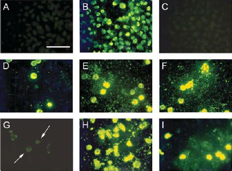 Nuclear Apoptosis Occurs In A Two Step Manner In Hela Cells Exposed To