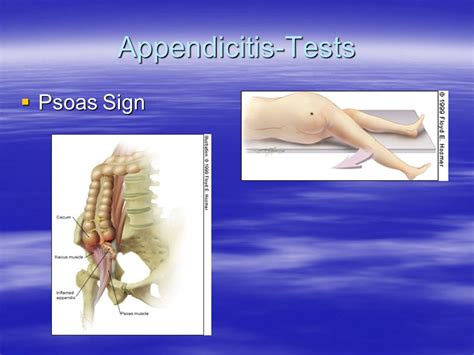 Gastroenterology Pathology Ppt Video Online Download