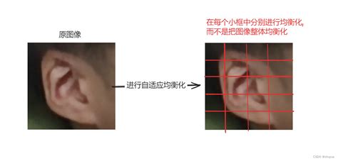 Opencv中的clahe算法：图像均衡化保持细节 Csdn博客