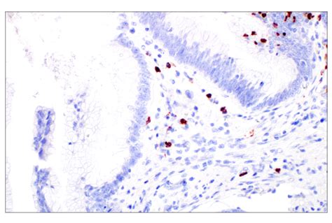 Mmp 8 E1c4l Rabbit Mab Cell Signaling Technology