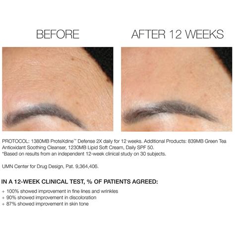 Protexidine™ Sun Defense Discoloration Defender Hh Science