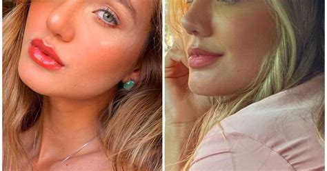 Biah Rodrigues Corrigiu O Nariz Em Uma Rinoplastia E Mostrou O Antes E Depois Purepeople