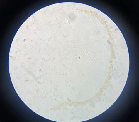 Trichostrongylidosis Flashcards Quizlet