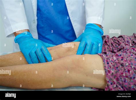Asian Elderly Woman Patient With Scar Knee Replacement Surgery In