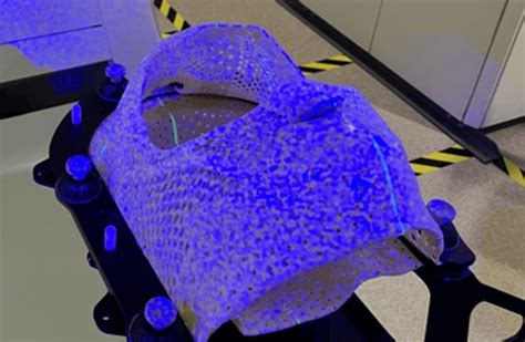 Initial Experience Of Implementing A Pre Treatment Dry Run For Hyperarc Stereotactic