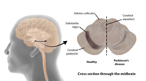 Midbrain Diagram Tectum And Tegmentum Anatomy Structure And Function