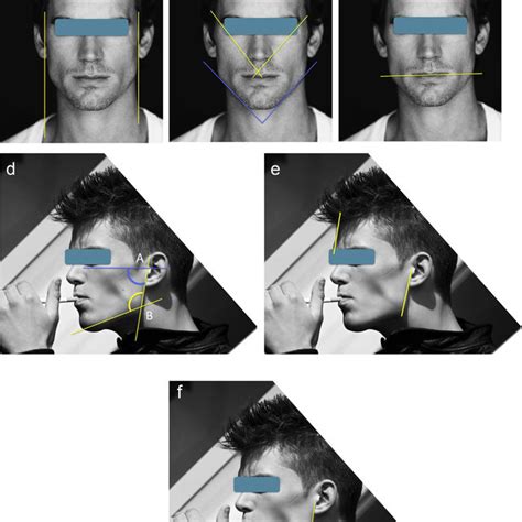 Answers To Question 3 Regarding The Aesthetics Of Bigonial Width