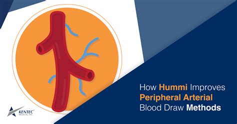 How Hummi Improves Peripheral Arterial Blood Draw Methods How Hummi Improves Peripheral Arterial Blood Draw Methods