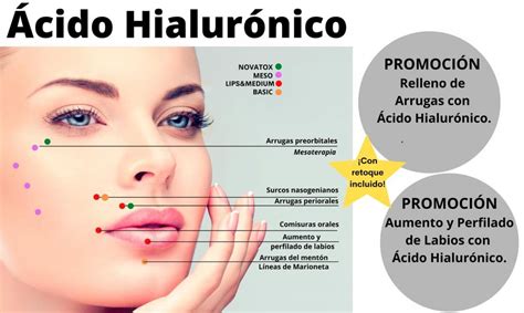 Ácido Hialurónico Dup Ortodonciasantonja