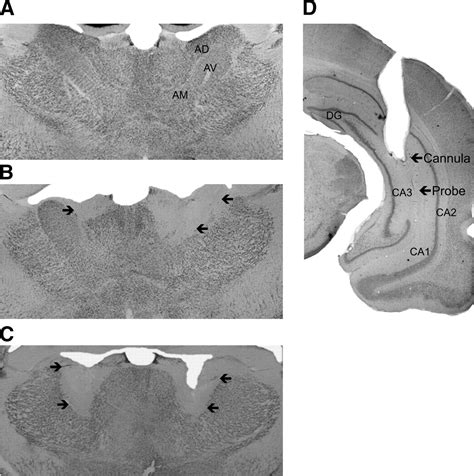 Anterior Thalamic Lesions Alter Both Hippocampal Dependent Behavior And