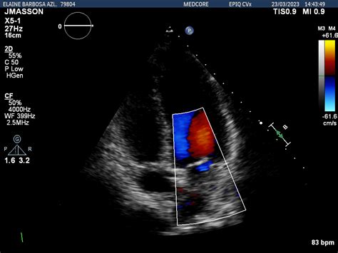 Rmmodel Instance Segmentation Dataset By Vilson Soares De Siqueira